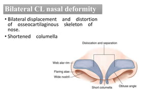 Embryology & Surgical Anatomy of Cleft Lip.pptx