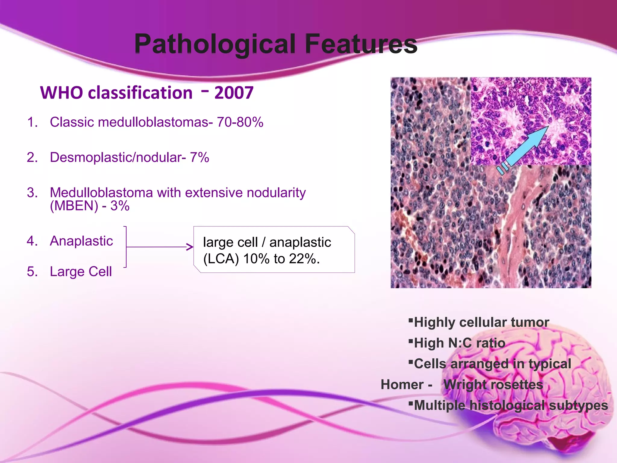 Embryonal brain tumours in children | PPT