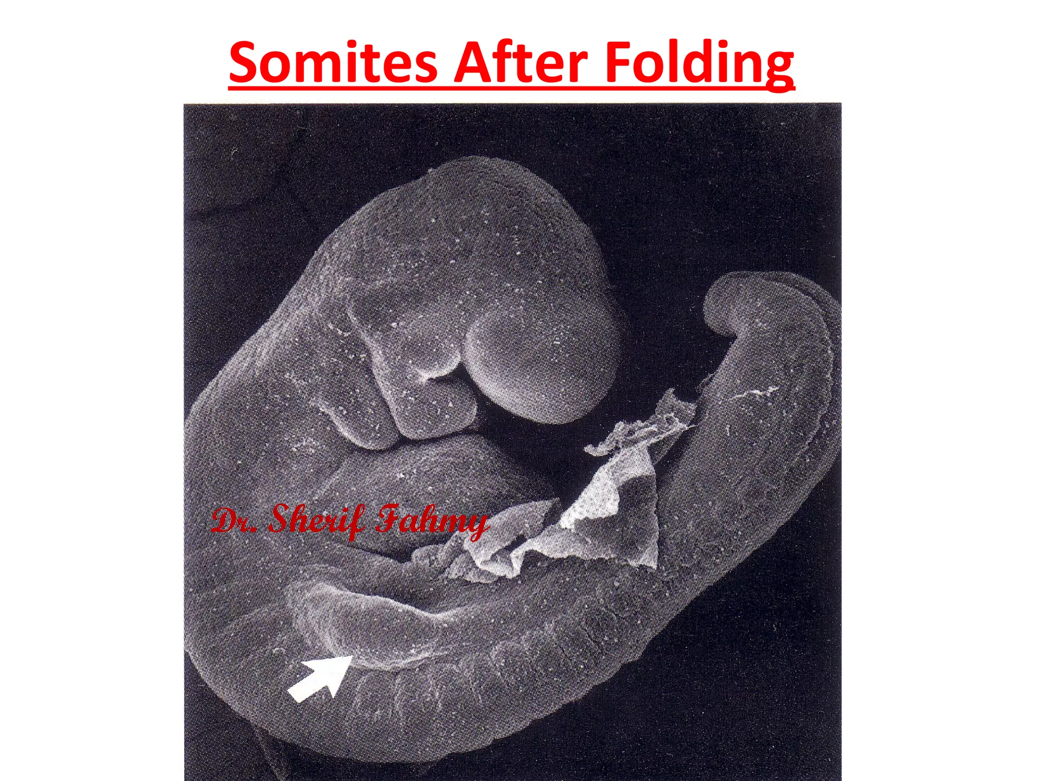 Embryonic period 4th – 8th week & Folding (General Embryology) | PPS