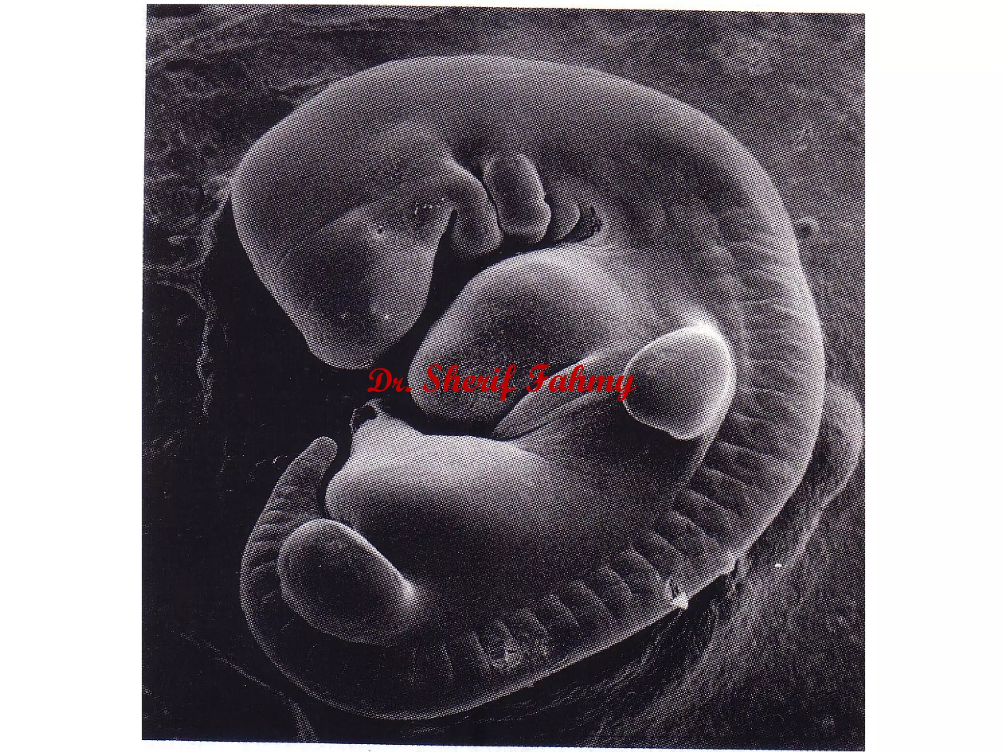 Embryonic period 4th – 8th week & Folding (General Embryology) | PPS