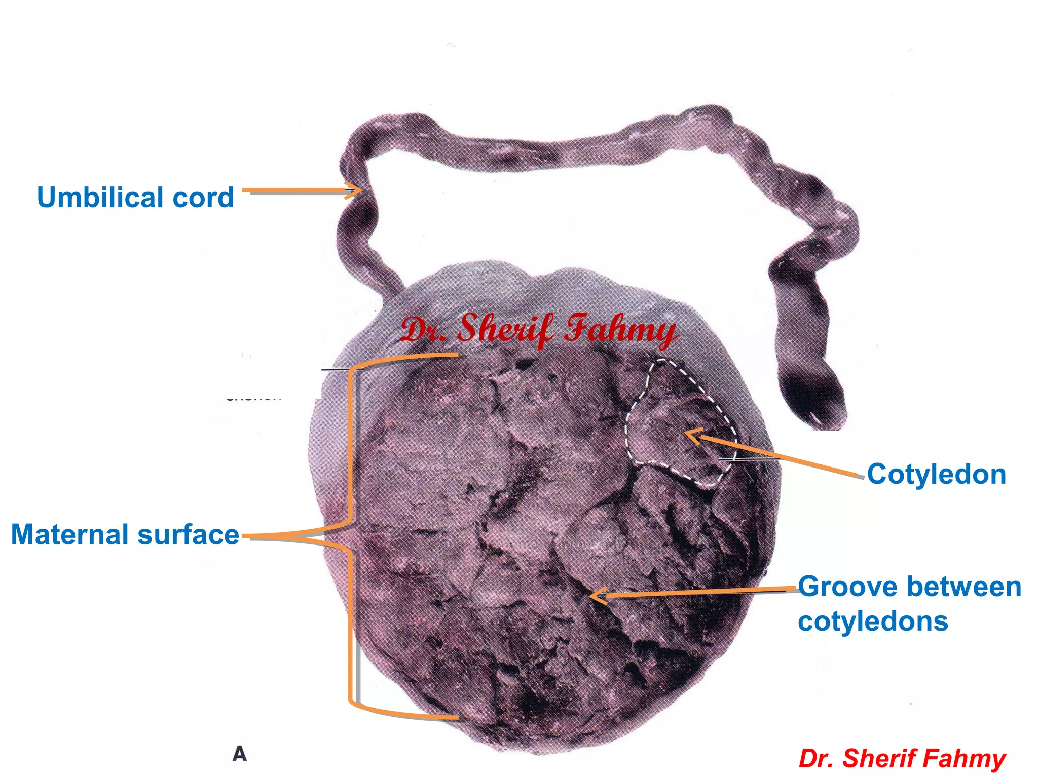 Embryonic period 4th – 8th week & Folding (General Embryology) | PPS