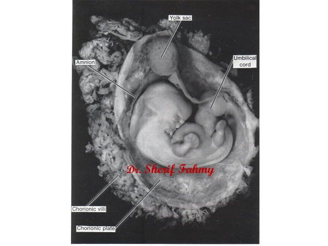 Embryonic period 4th – 8th week & Folding (General Embryology) | PPS