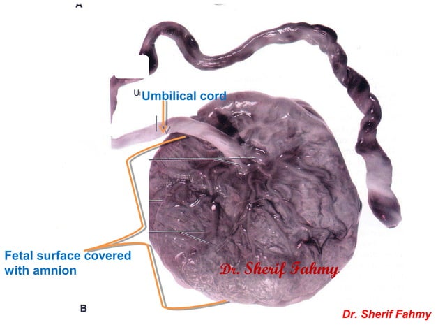 Embryonic period 4th – 8th week & Folding (General Embryology) | PPS