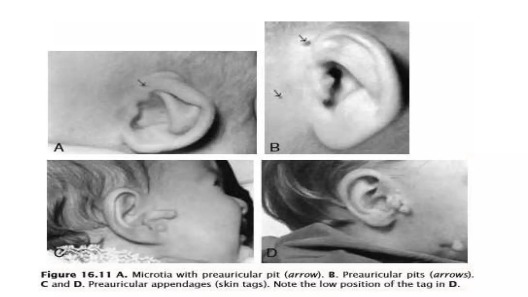 Embryo of Ear and Nose | PPT