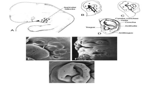 Embryo of Ear and Nose | PPT