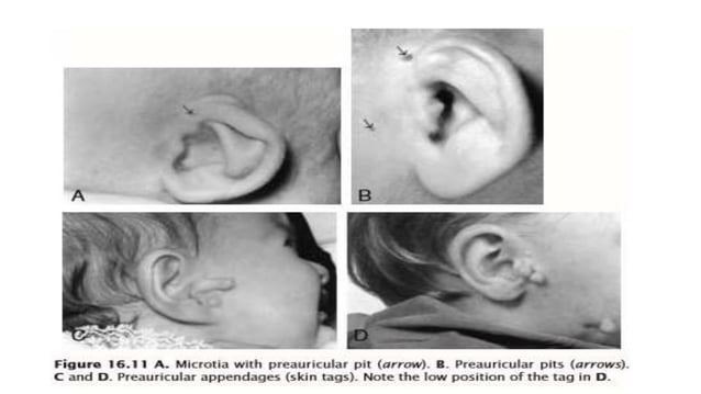 Embryo of Ear and Nose | PPT