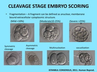 EMBRYO QUALITY ASSESSMENT, WHICH TO SELECT? | PDF