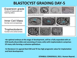 EMBRYO QUALITY ASSESSMENT, WHICH TO SELECT? | PDF