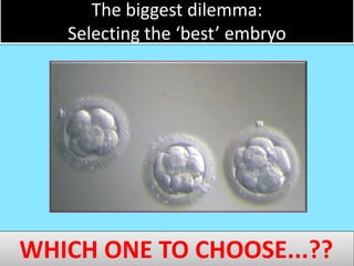 EMBRYO QUALITY ASSESSMENT, WHICH TO SELECT? | PDF