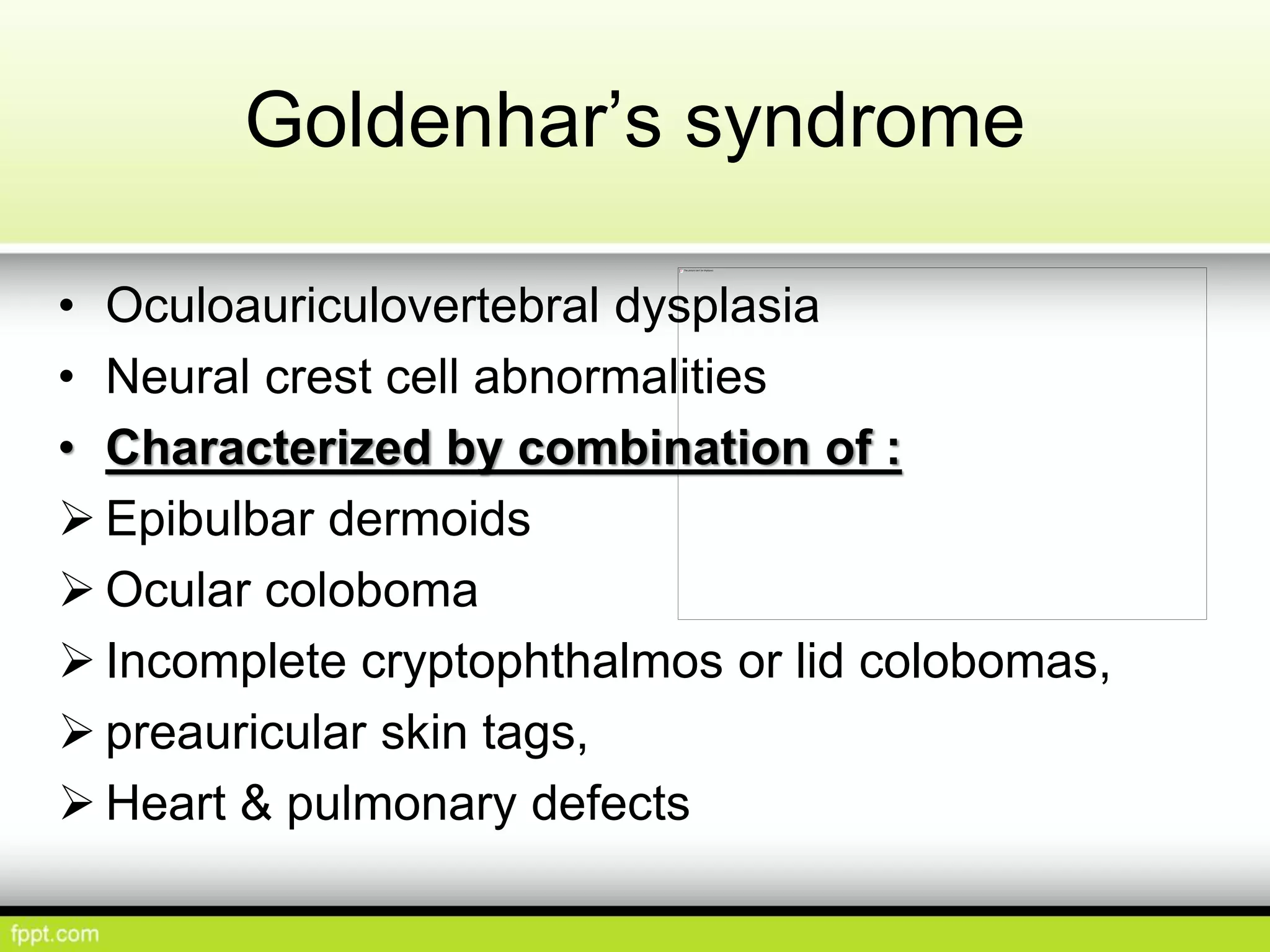 Ocular Embryology | PDF