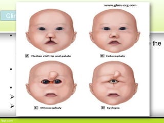 Ocular Embryology | PDF