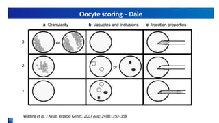 Embryo scoring stage wise gametes ....... | PPTX