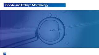 Embryo scoring stage wise gametes ....... | PPTX