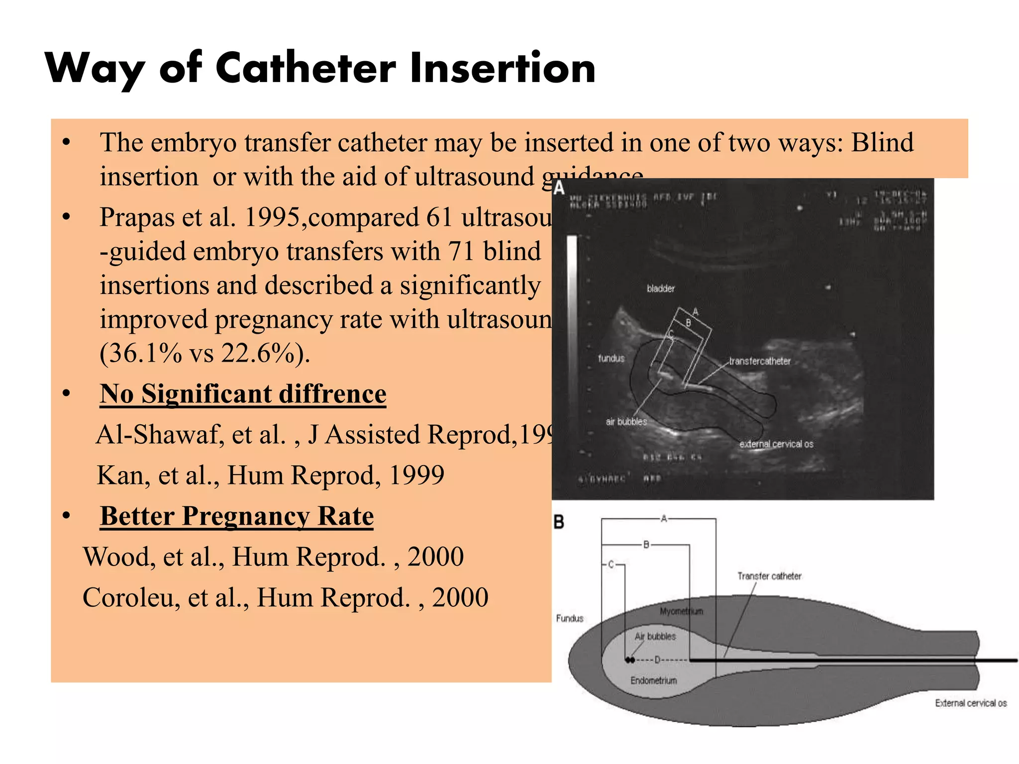 Embryo transfer | PPTX