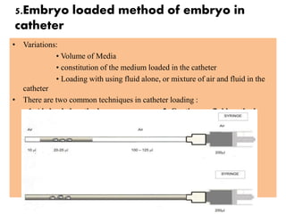 Embryo transfer | PPTX
