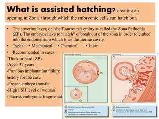 Embryo transfer | PPTX