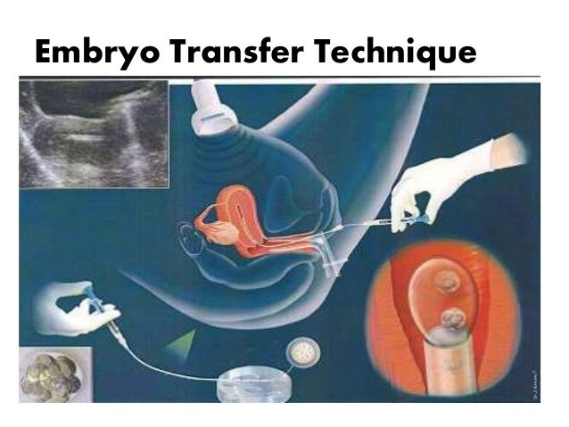 Embryo transfer