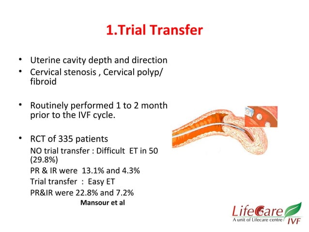 Embryo loading & Transfer , Lifecare IVF Dr. Aruna Saxena | PPT