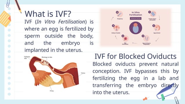 Embryo Transfer Procedure for IVF Breakthrough by Slidesgo.pptx