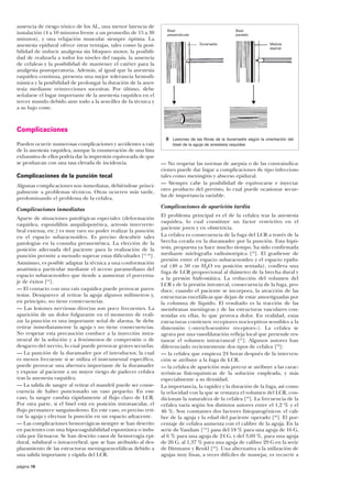 EMQ.Anestesia Raquidea | PDF