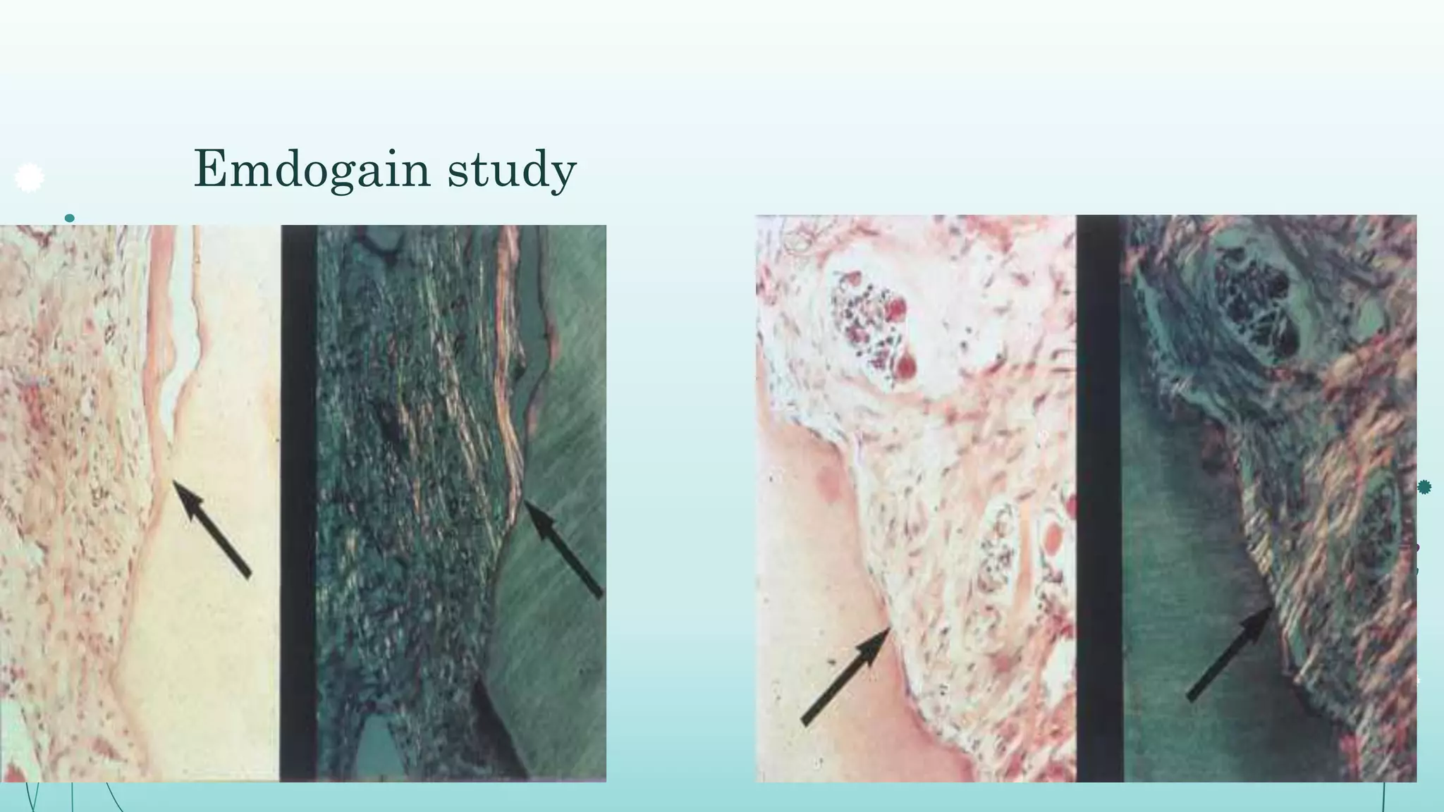 Emdogain by dr. maryam salman | PPTX