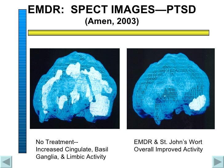EMDR - Wholeness Counseling