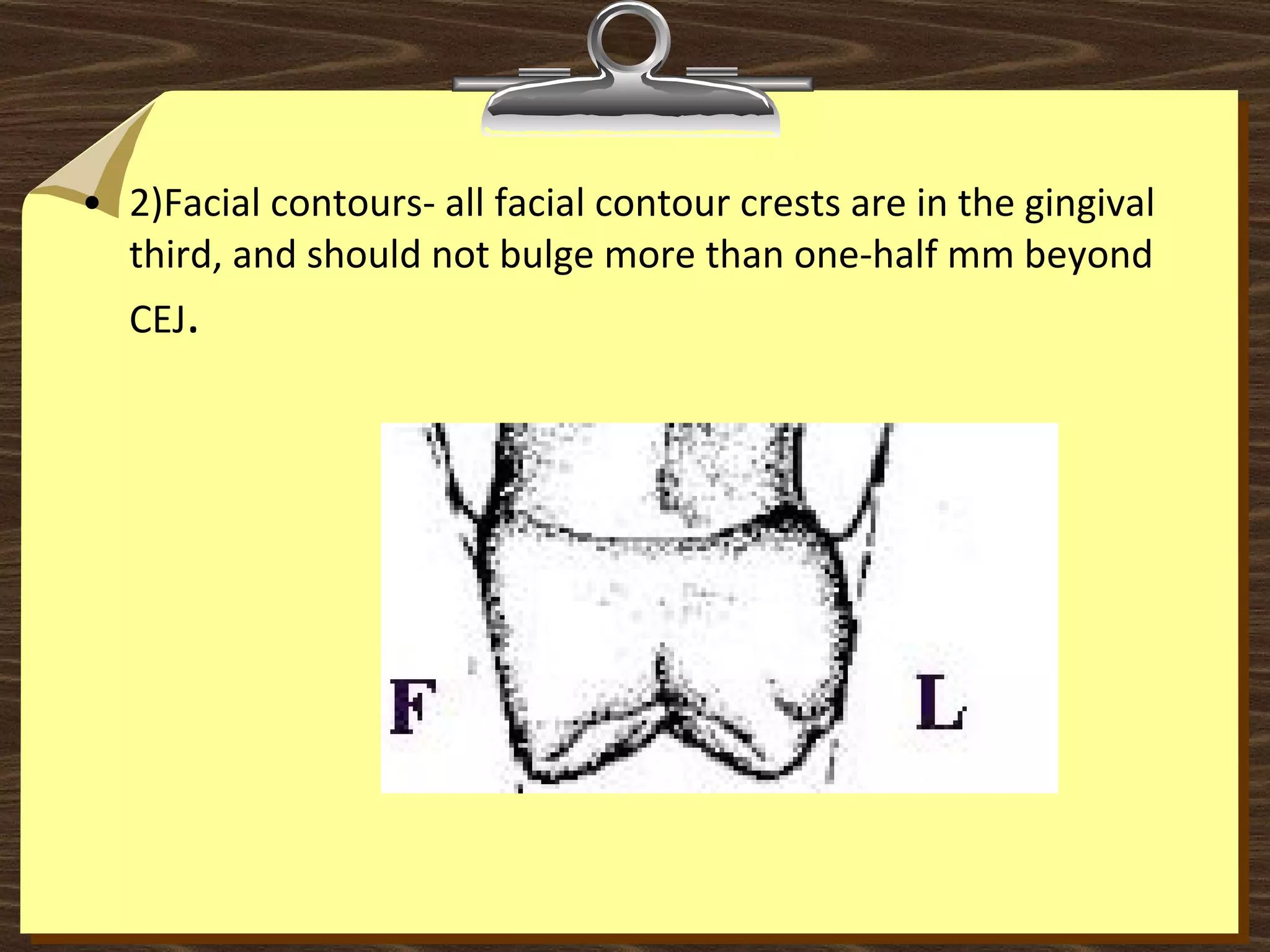 Emergence profile in fixed partial denture. | PPT