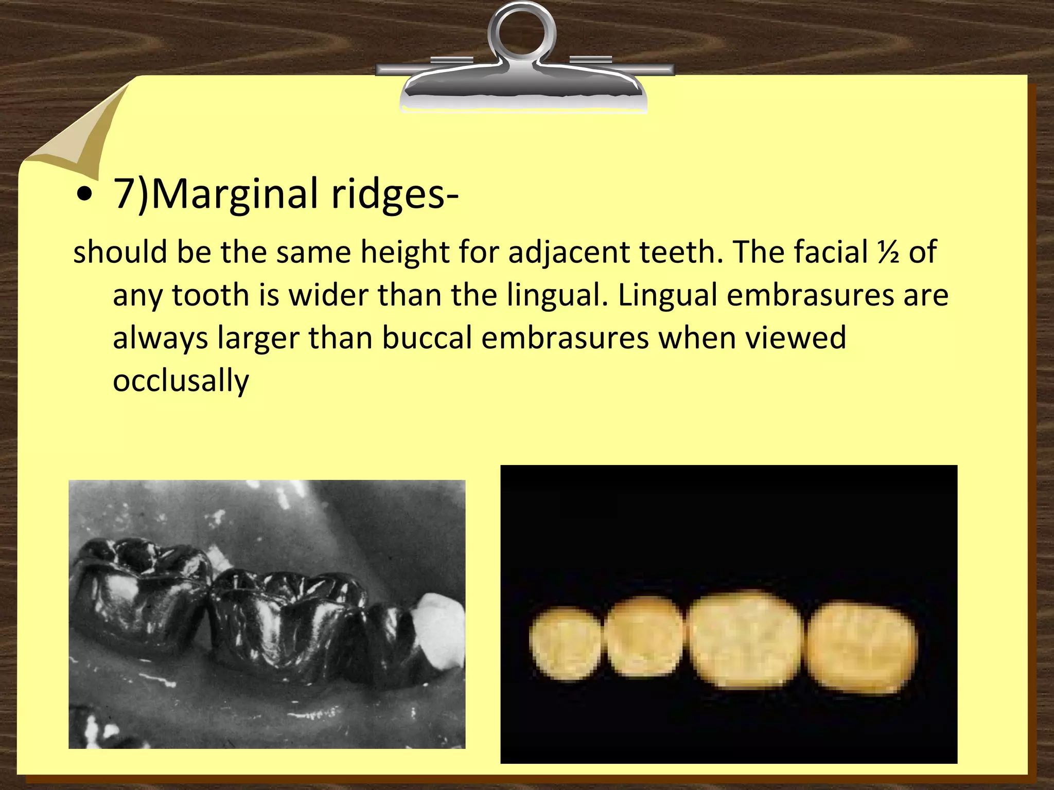 Emergence profile in fixed partial denture. | PPT