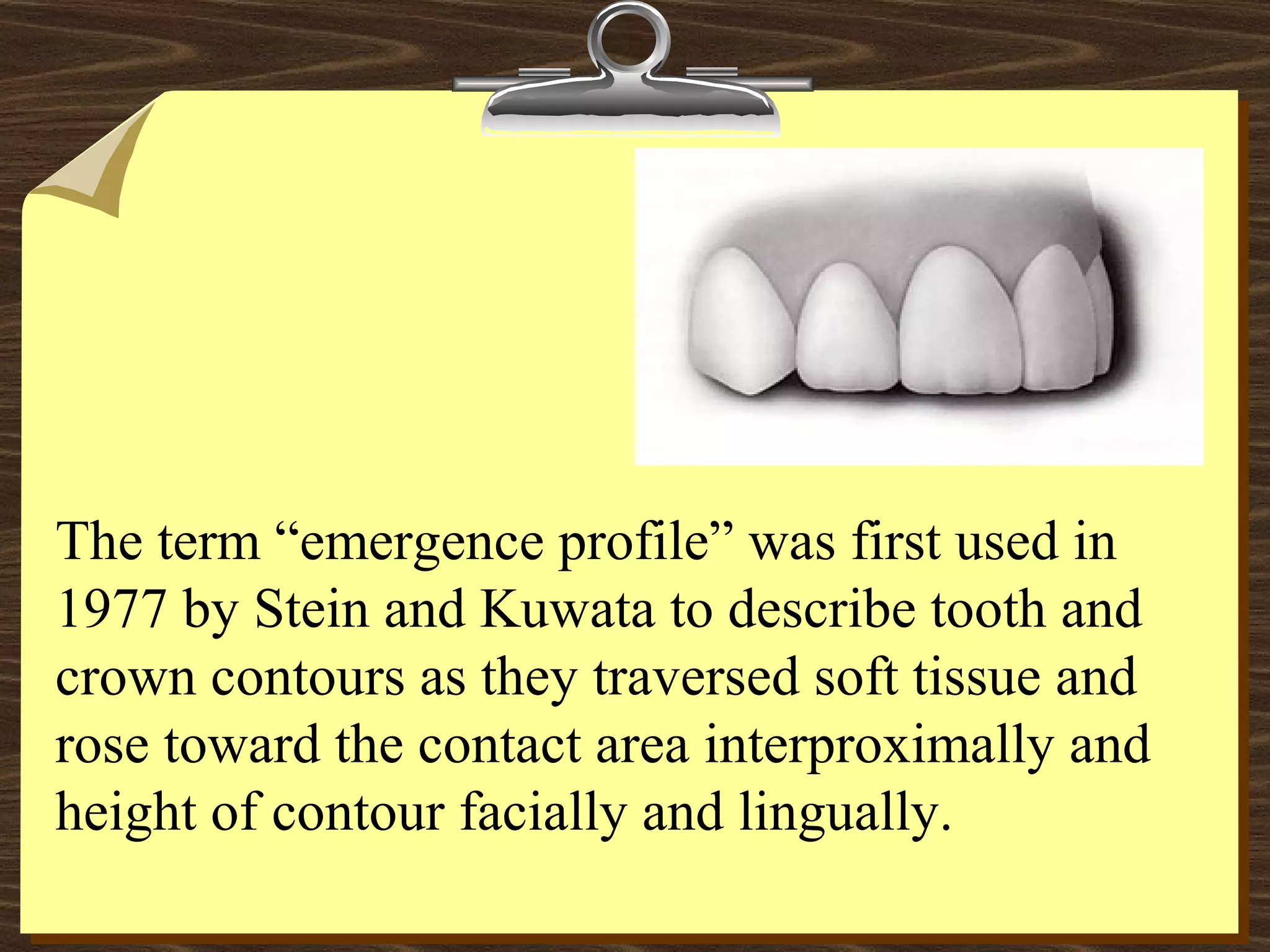 Emergence profile in fixed partial denture. | PPT