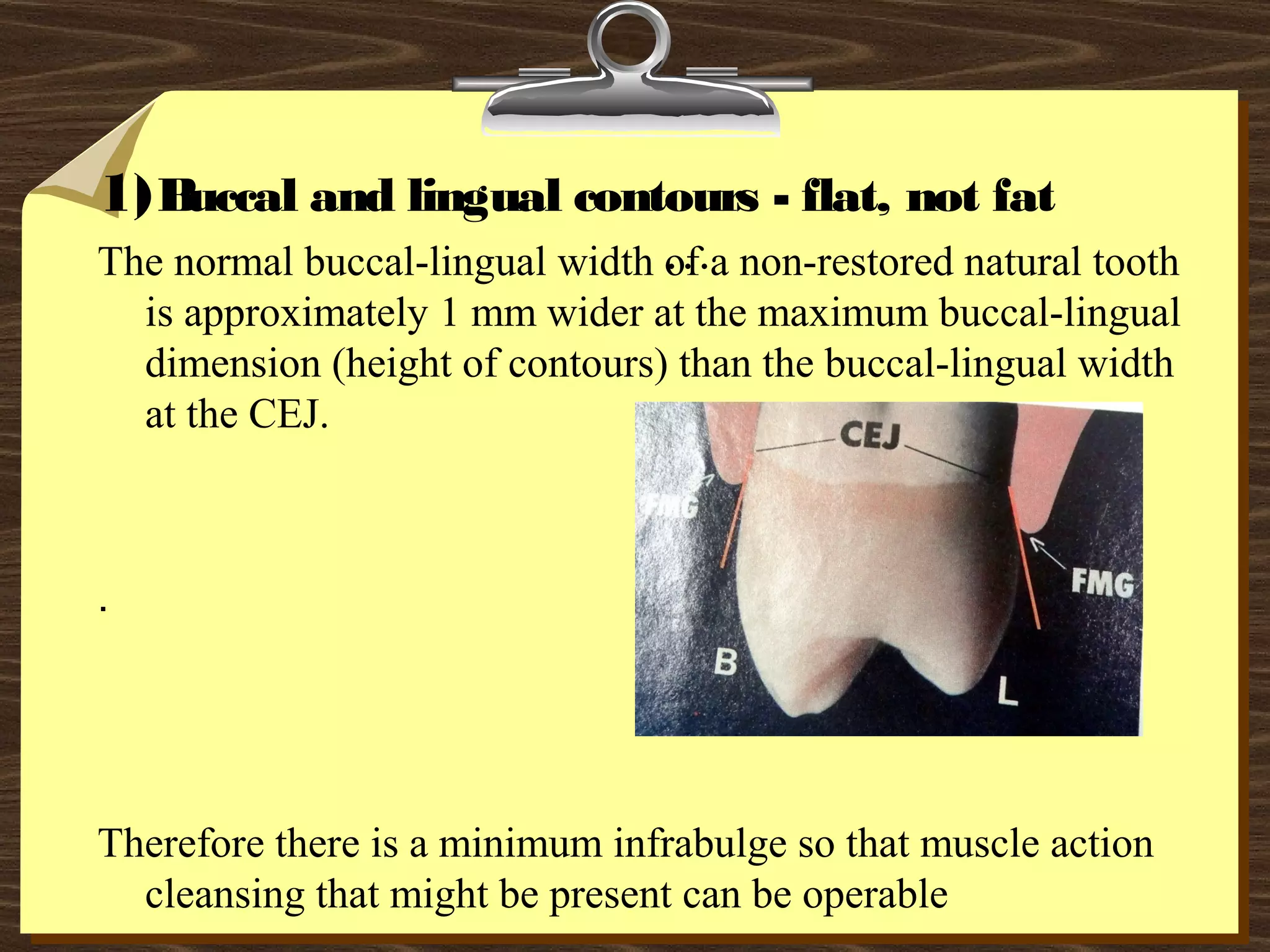 Emergence profile in fixed partial denture. | PPT