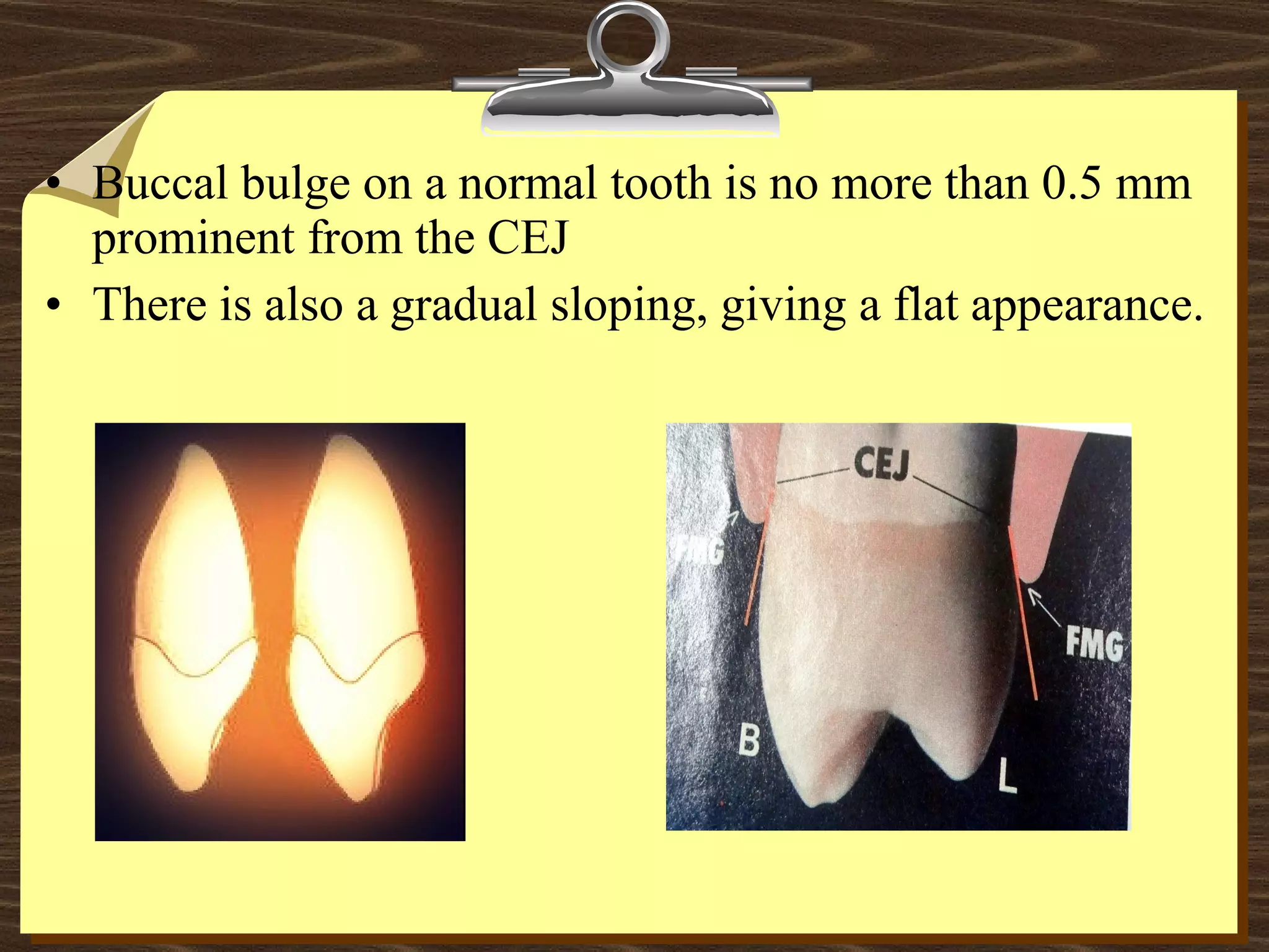 Emergence profile in fixed partial denture. | PPT