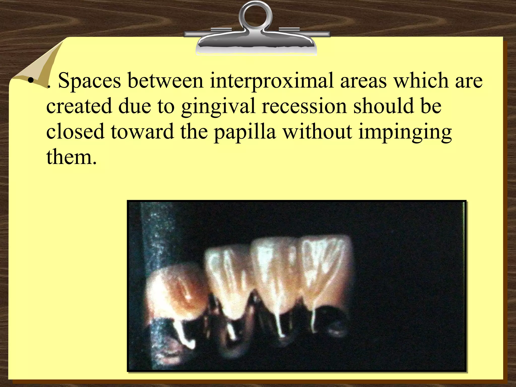 Emergence profile in fixed partial denture. | PPT