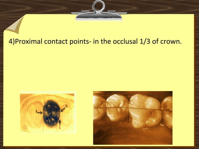 Emergence profile in fixed partial denture. | PPT | Dental Health ...