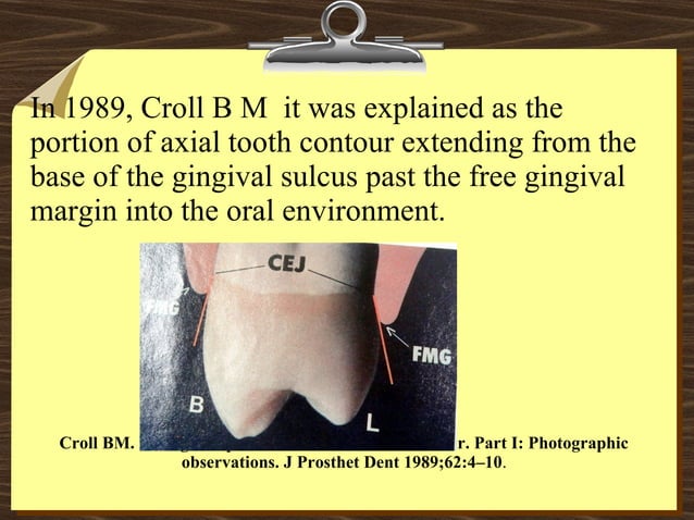 Emergence profile in fixed partial denture. | PPT | Dental Health ...