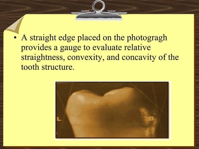 Emergence profile in fixed partial denture. | PPT | Dental Health ...
