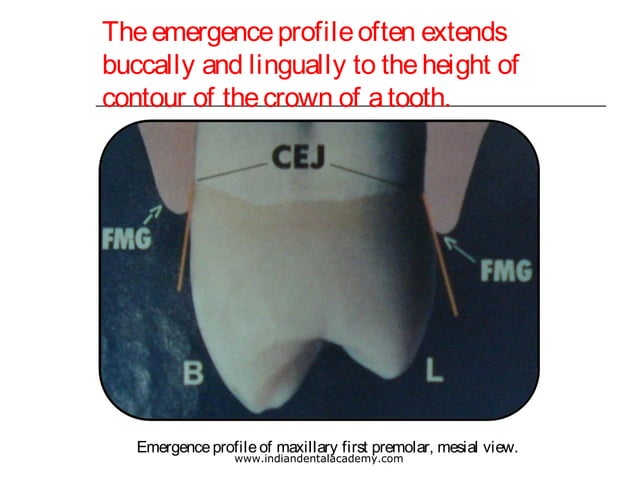Emergence profile done/ new dentistry technology | PPT
