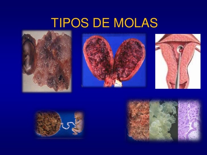 Emergencia Obstetrica