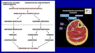 Emergencias en traumatologia del día a día | PPTX