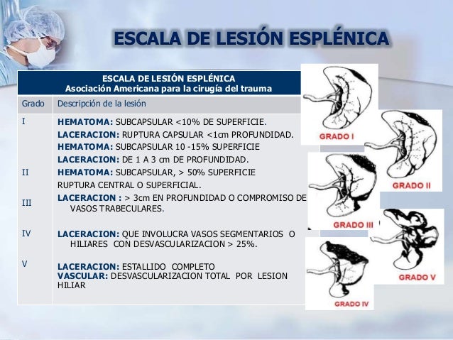 Esplenectomía: Cuando Operar