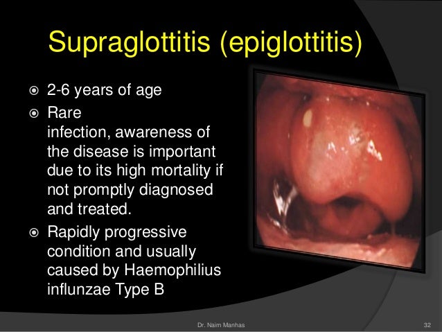 otolaryngological emergencies in neonate,infant and child