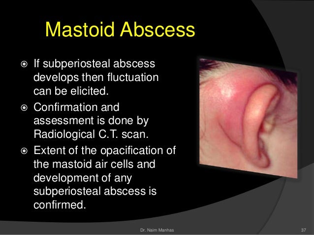 otolaryngological emergencies in neonate,infant and child