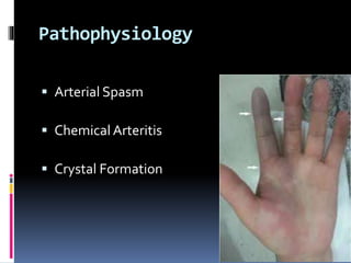Emergencies in vascular surgery | PPTX
