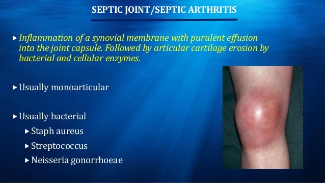 Orthopaedic Emergencies