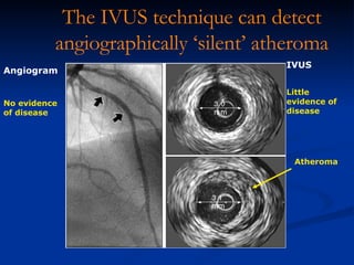Emergency Cardiology | PPT