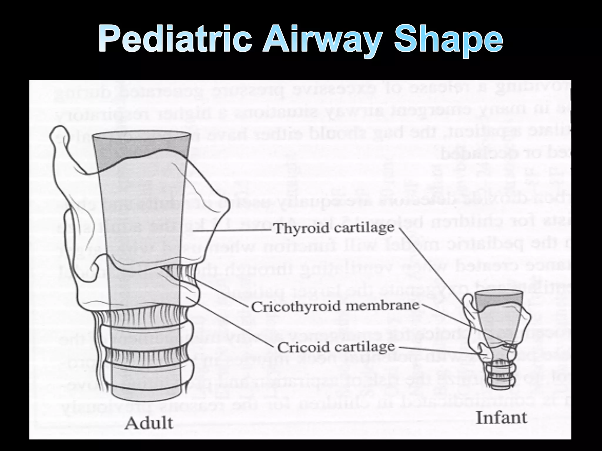 Emergency Airway Management 2014: Mark P. Brady PA-C | PDF
