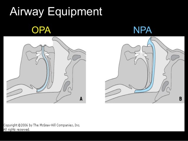 Emergency Airway Management 2014: Mark P. Brady PA-C