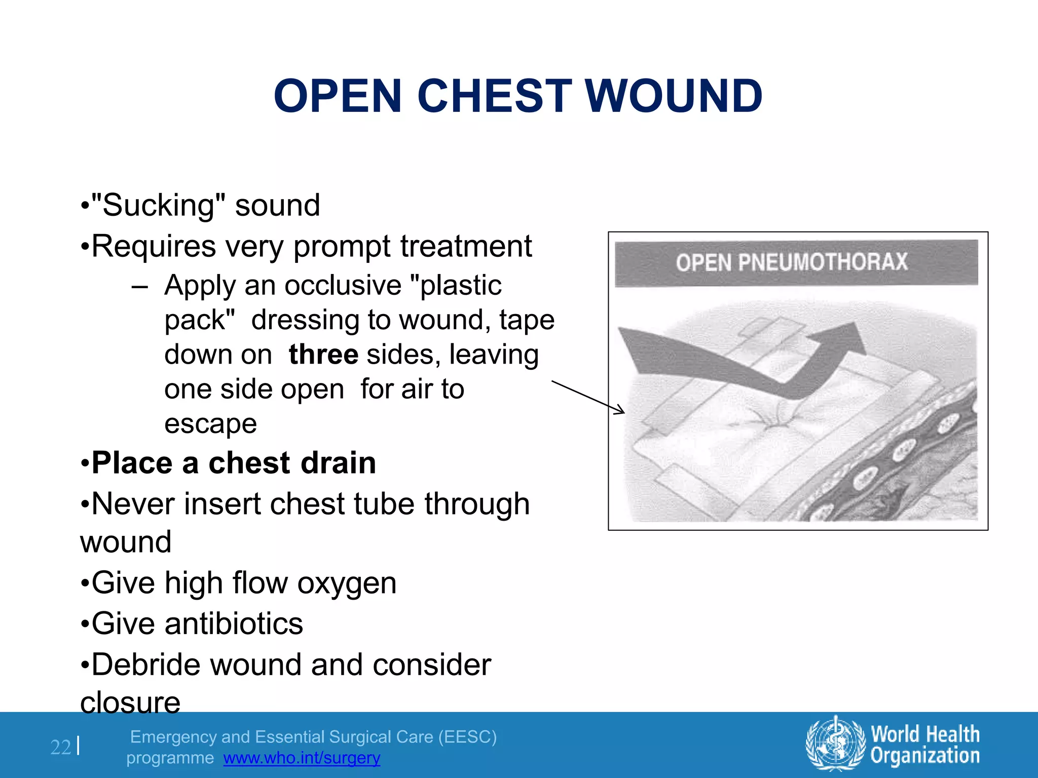 Emergency and trauma care | PPTX