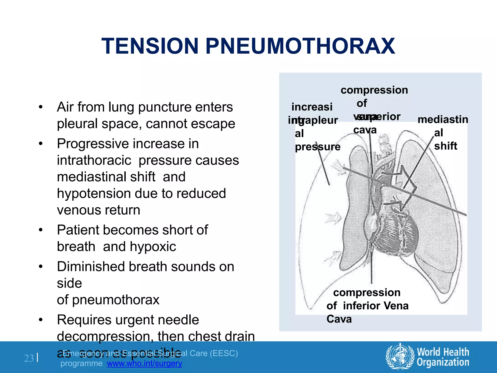 Emergency and trauma care | PPTX