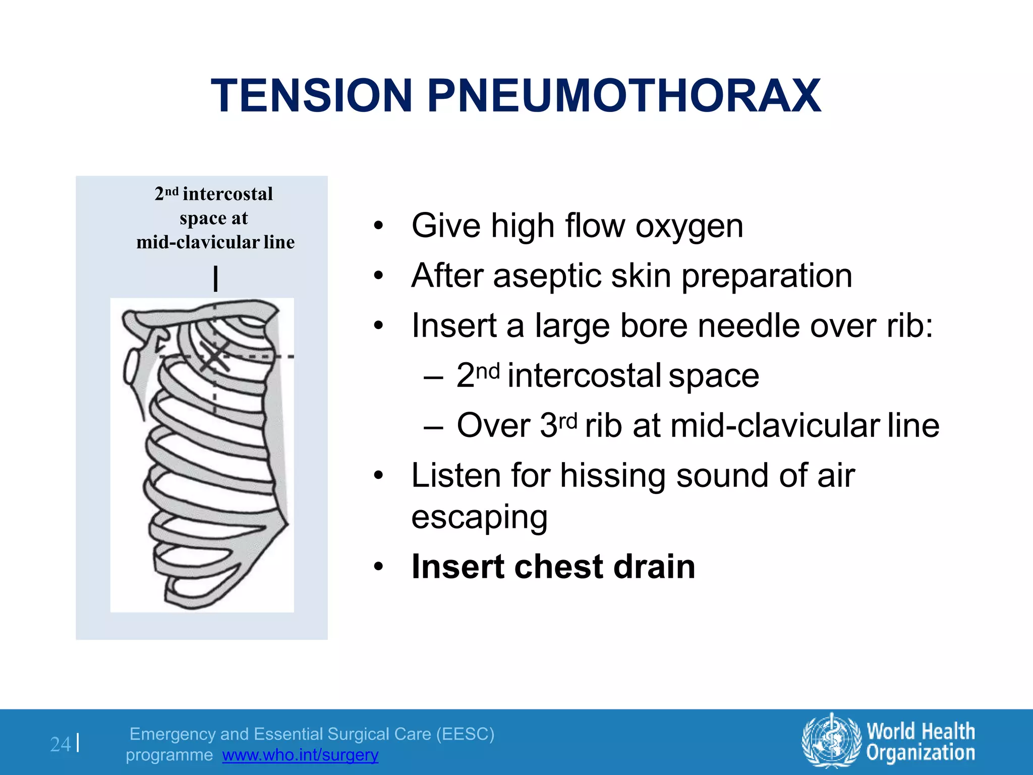 Emergency and trauma care | PPTX