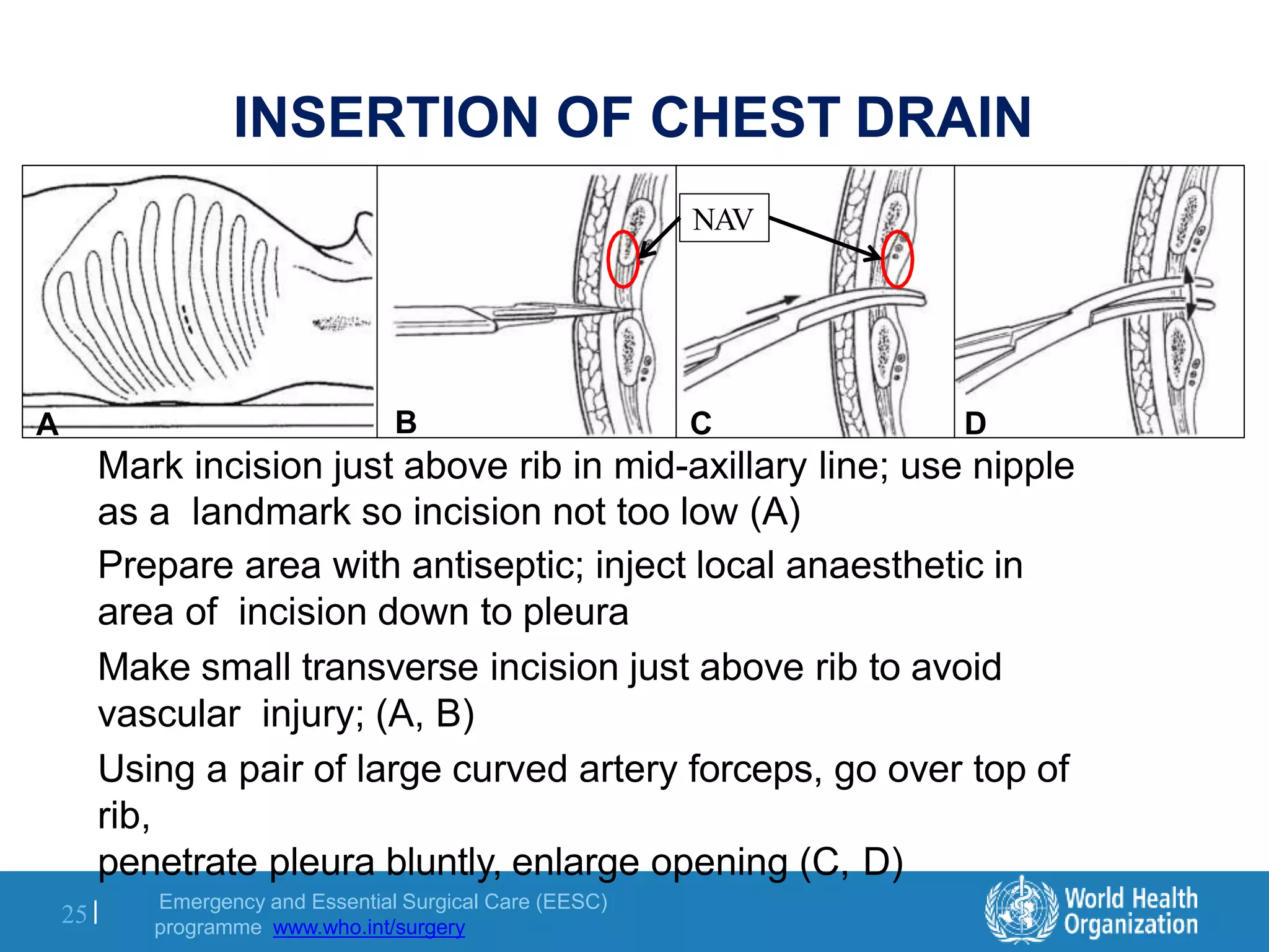 Emergency and trauma care | PPTX